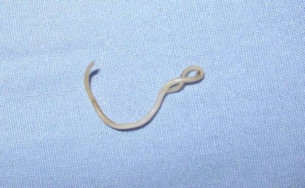 Roundworms In Dogs: Symptoms, Treatment & Prevention