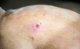 Dog Skin Cancer: 4 Common Types, Causes, Signs, Treatment & More
