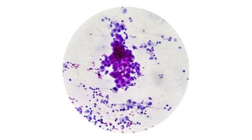 Fibrosarcoma In Dogs: Symptoms, Diagnosis, Treatment & Prognosis
