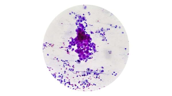 Fibrosarcoma In Dogs: Symptoms, Diagnosis, Treatment & Prognosis